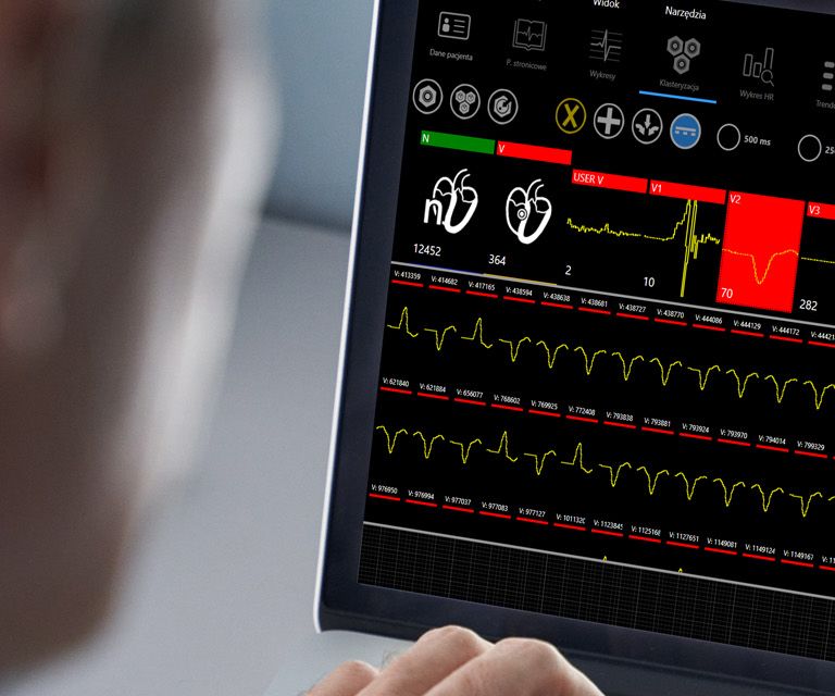 Cardiac diagnostic support software